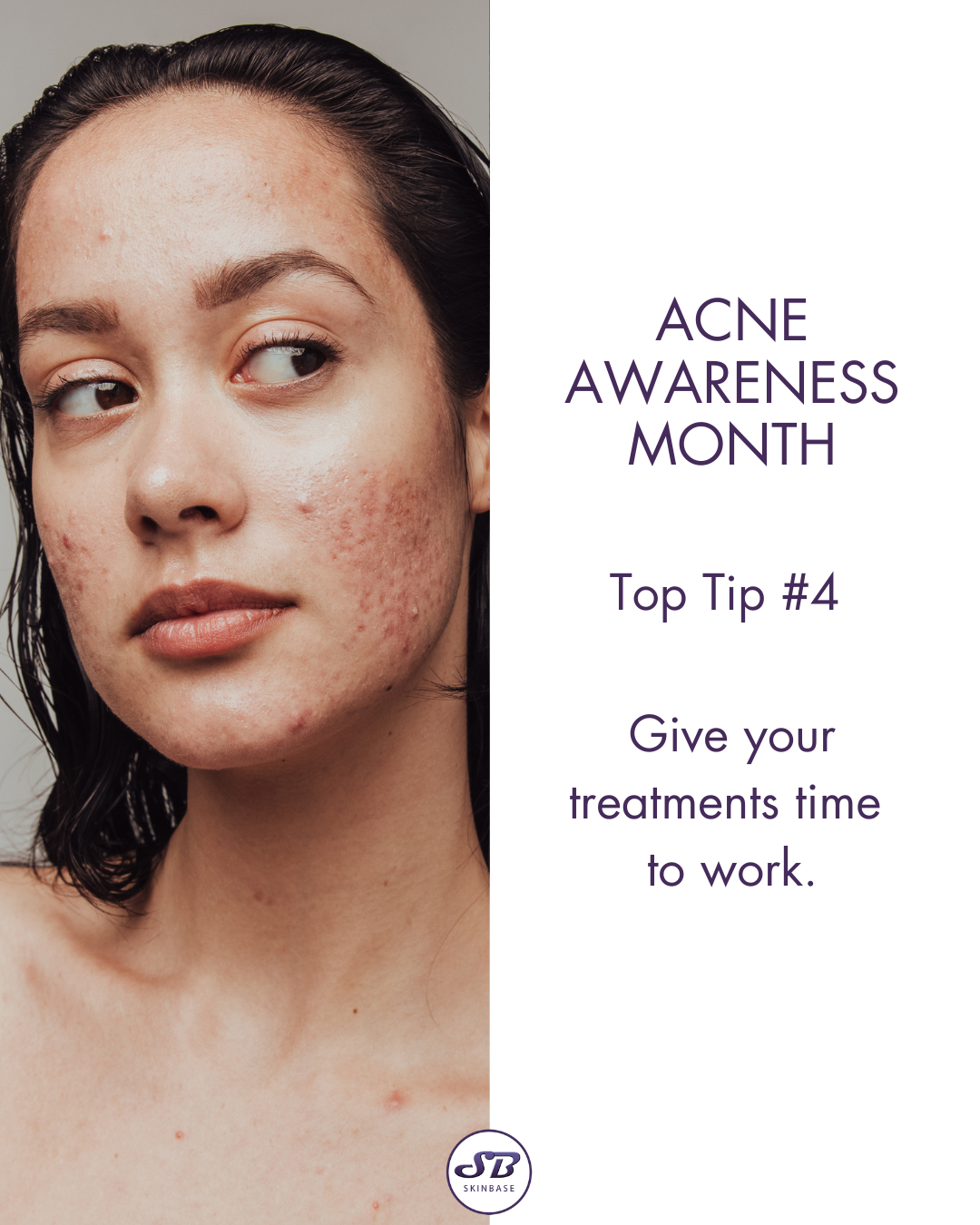 Acne Awareness Month - Microdermabrasion Grid Post Series